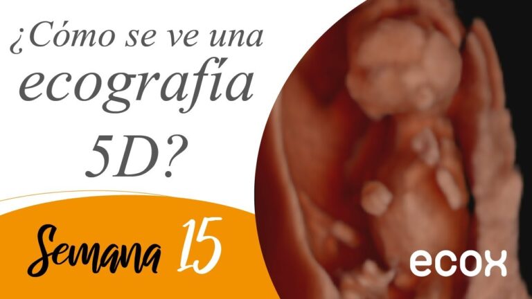 Todo lo que debes saber sobre la ecografía de 15 semanas de embarazo: guía completa - La Befana